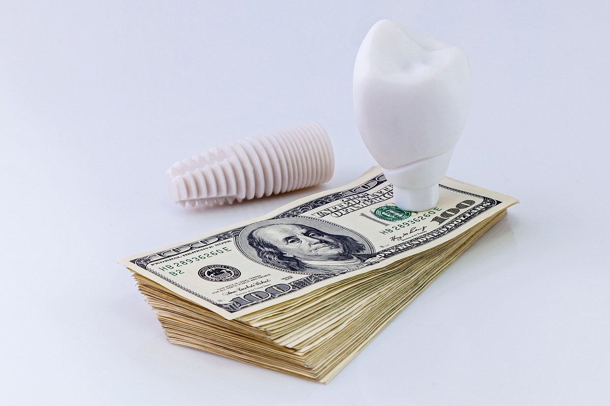 Discover How Much You Can Expect to Pay for Dental Implants in Oakton?